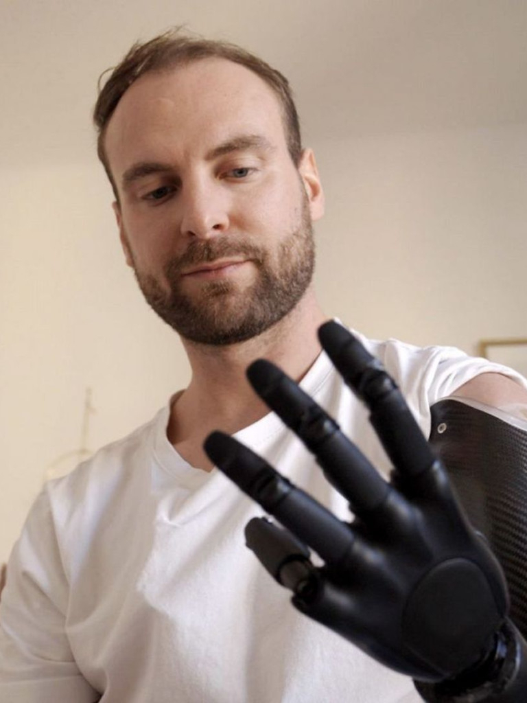 La mano extraordinaria: del tacto a la victoria | SincroGuia TV